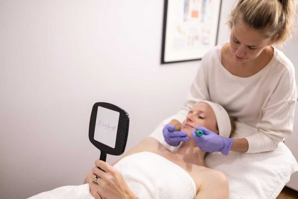 Micro-needling - Wandsworth Physiotherapy and Osteopathy