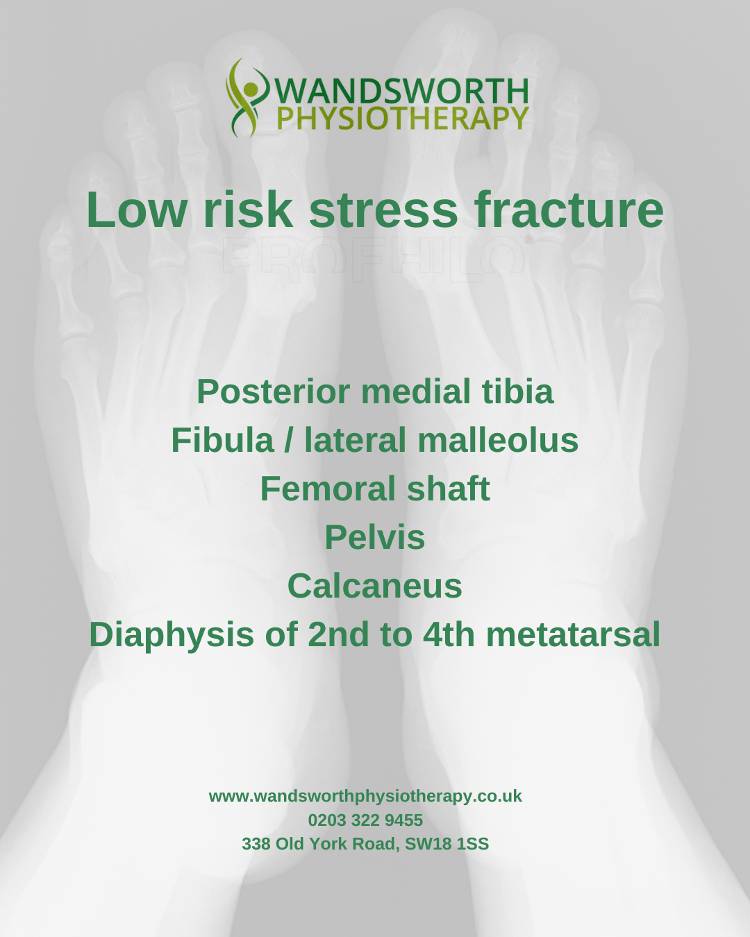 Bone stress injury and return to running: 5 ways to manage BSI
